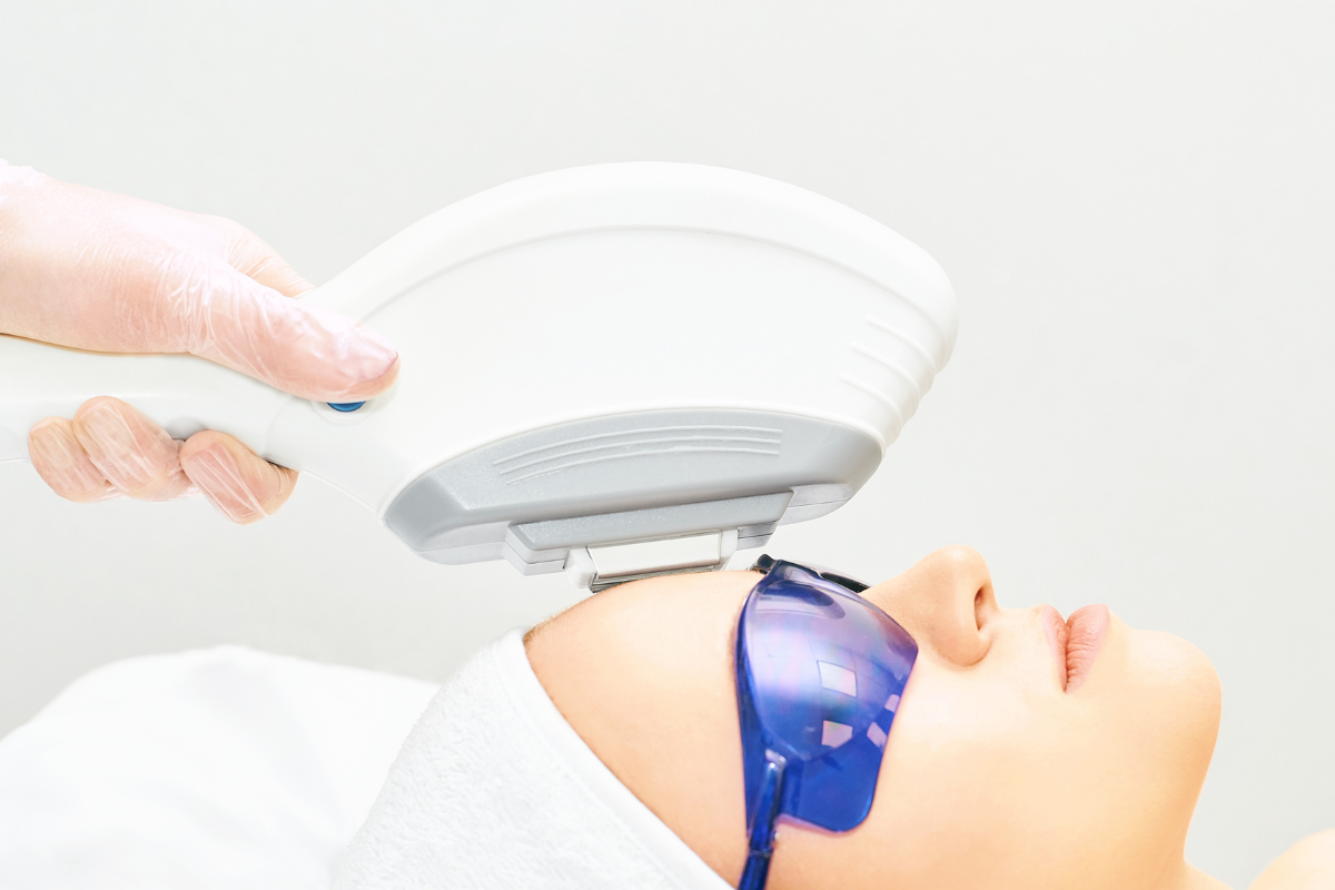 Remove Age Spots & Broken Capillaries with IPL Therapy